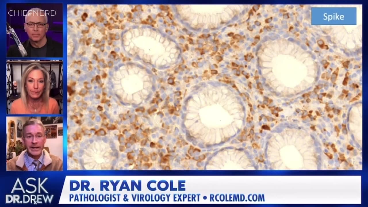- Dr. Ryan Cole Shares Terrifying Biopsy Results Which Could Explain ...